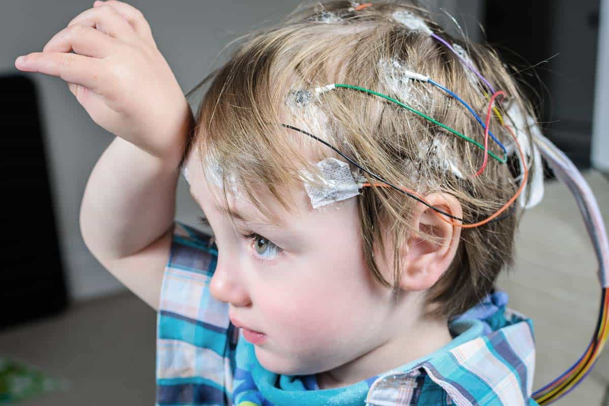 Cerebral Palsy And Seizures Cerebral Palsy Guidance